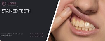 Top 6 Embarrassing Oral Health Problems | Leigh Dental Centre