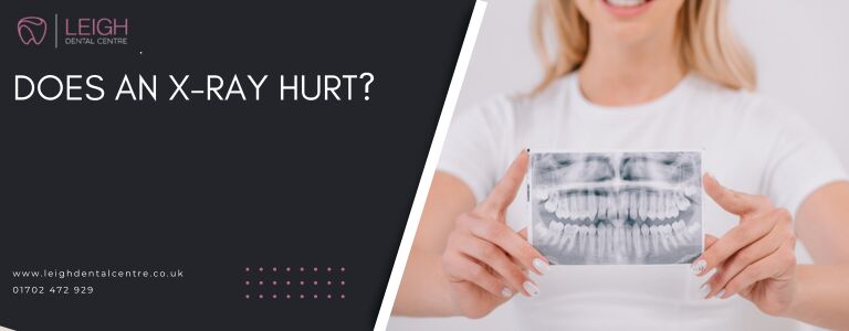 Dentist X-rays: All You Need to Know | Leigh Dental Centre