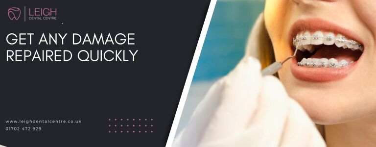 5 Tips to Care for Your Brace | Leigh Dental Centre